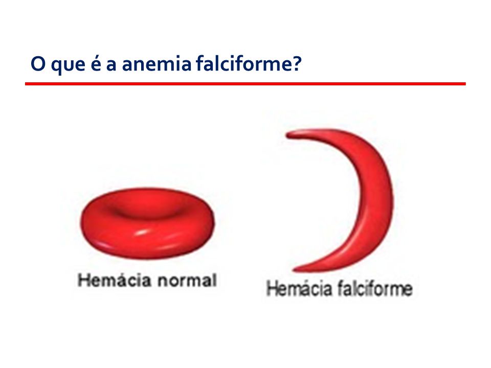 RosaBio: Anemia Falciforme