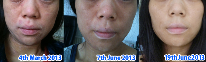 Dr. Fukaya's Skin Repair Lotion AVAILABLE NOW!