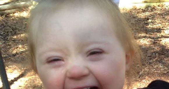 3 of 21: Brain Development in Down Syndrome May Be Enhanced, Doctor ...