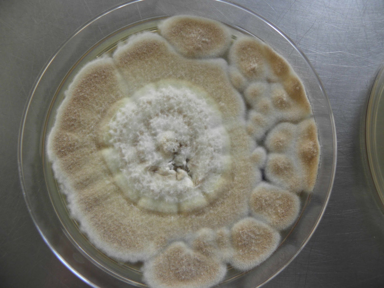 ATLAS MICOLOGIA: ASPERGILLUS TERREUS