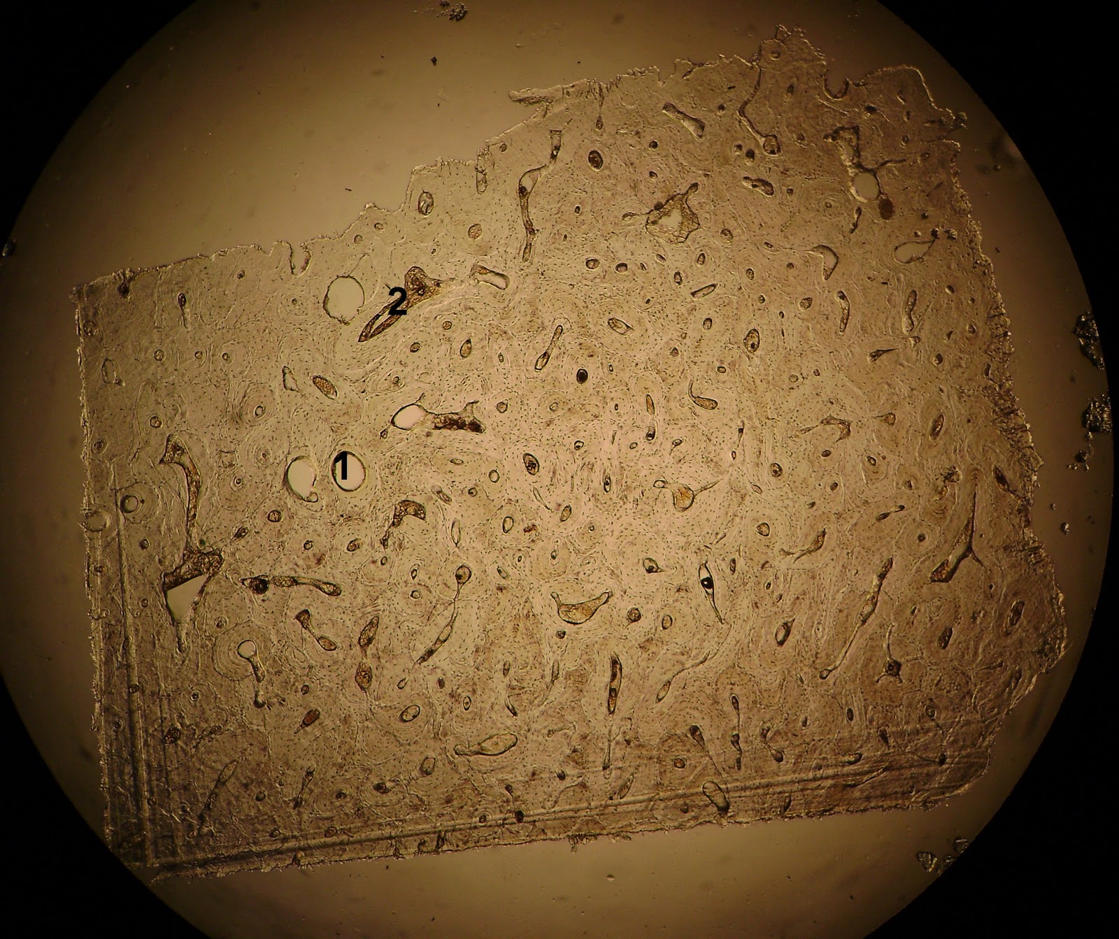 Histologia UFJF: Tecido Ósseo - Osso Compacto