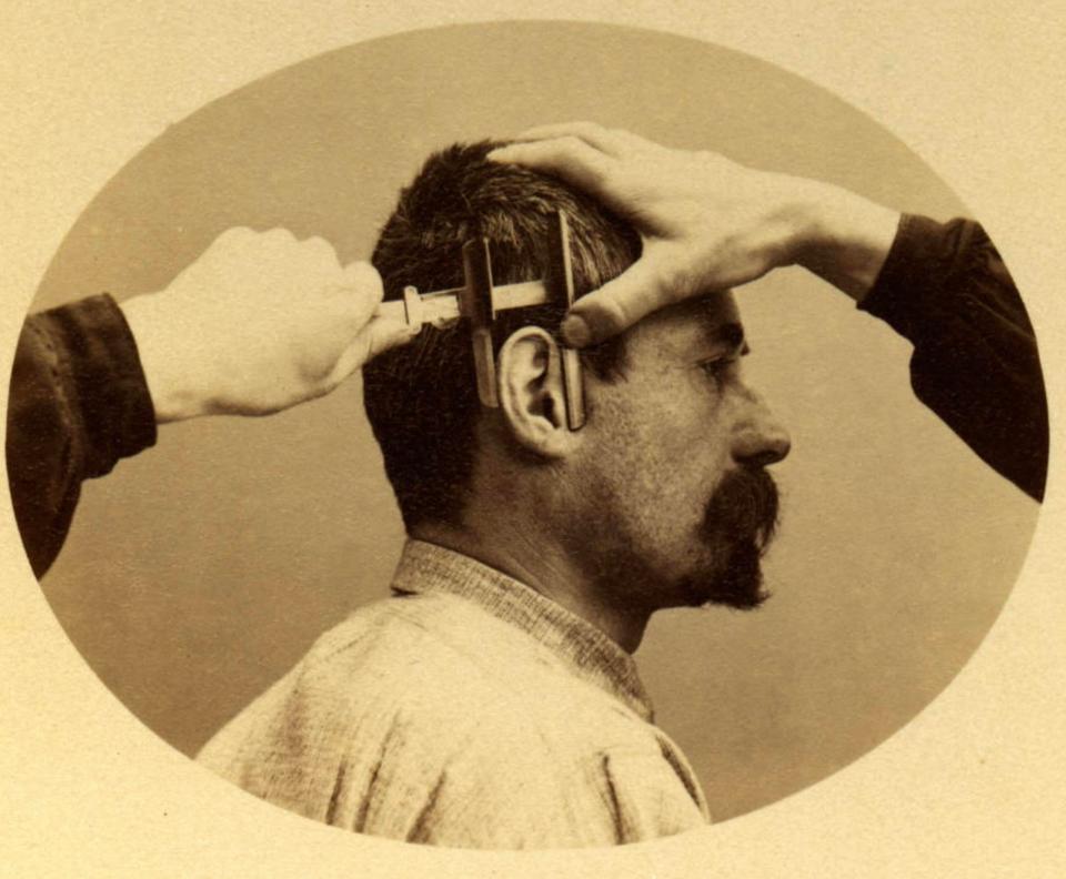 20 Haunting Photos From the Heyday of the Eugenics Movement at the Turn ...