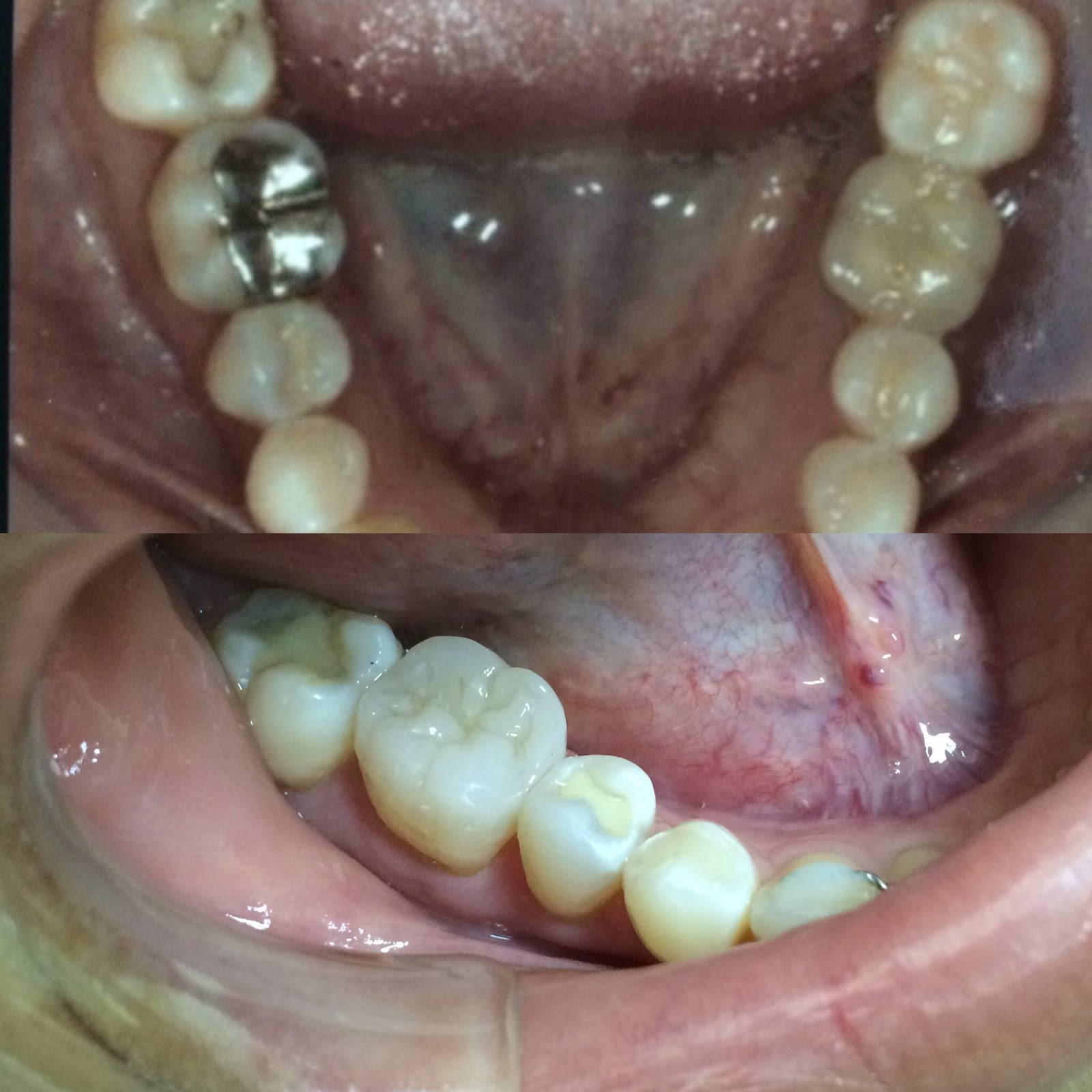 Odontologia - Dra Lívia Rocha: janeiro 2016