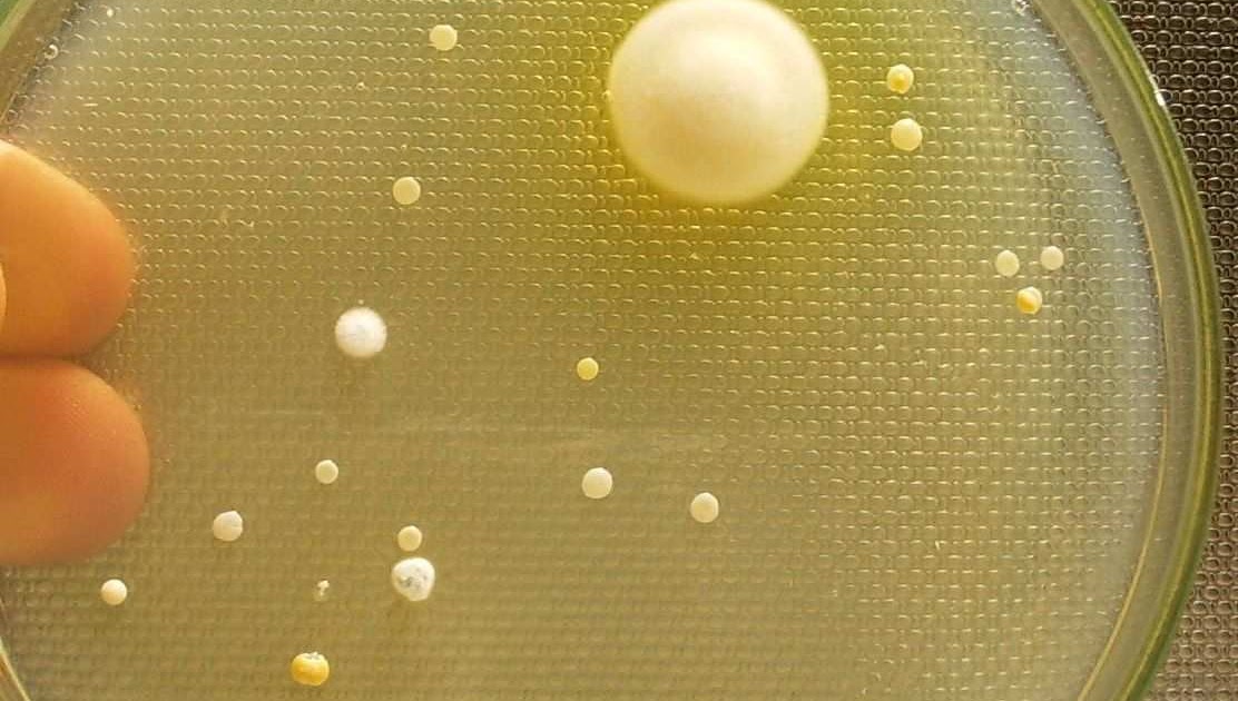 RECUENTO DE AEROBIOS MESOFILOS (RAM)