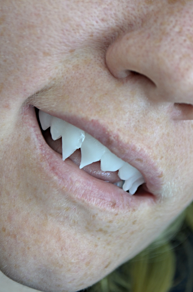 A world of creativity: Polymorph Teeth Walkthrough