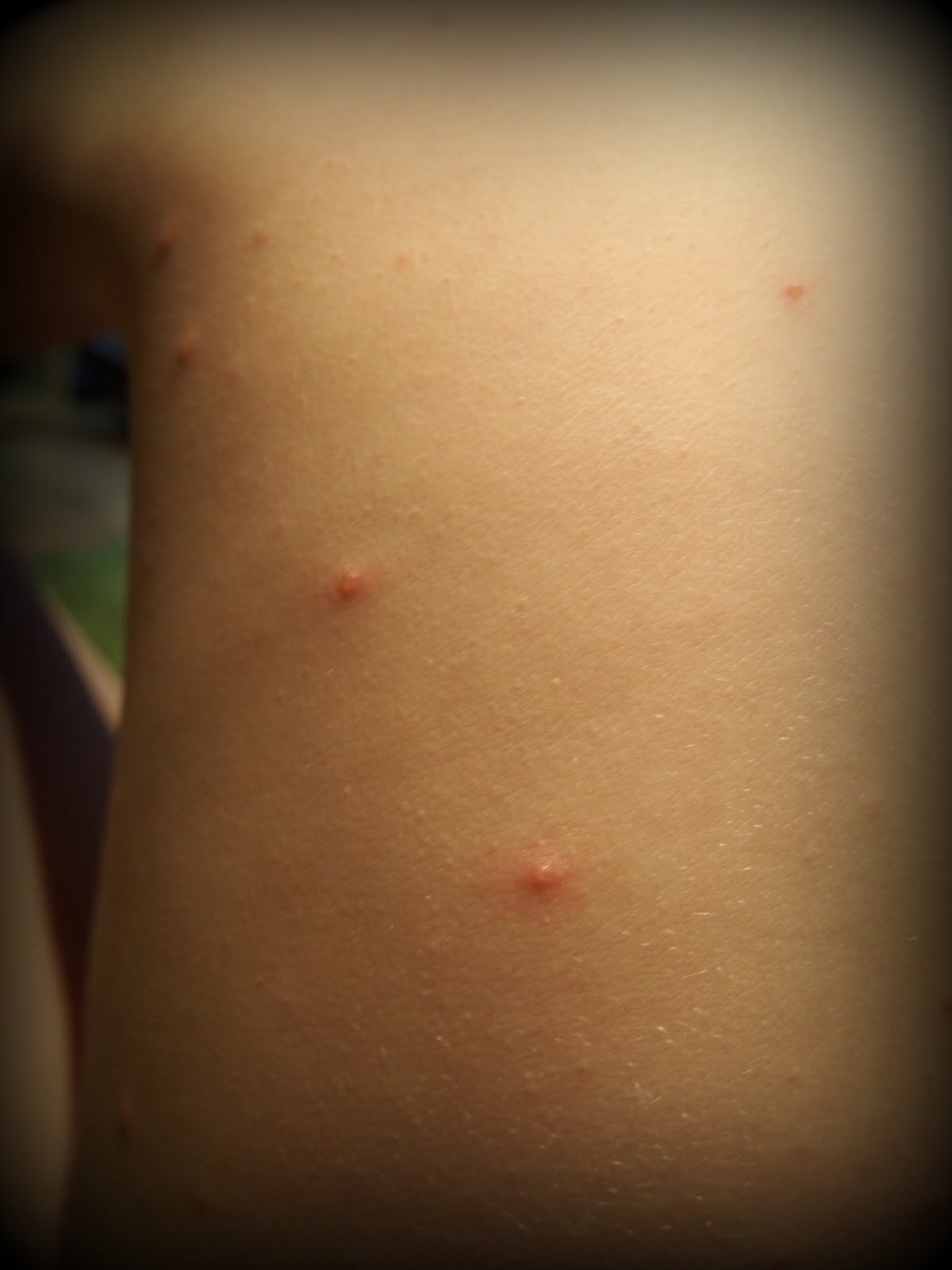 Myn kanssa: Voihan vesirokko