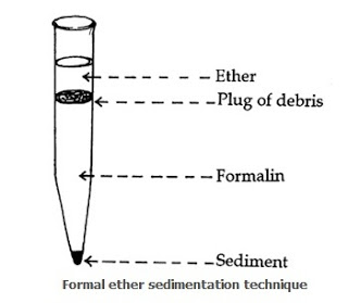 Lab Series# 7: O&P examination of Stool Samples