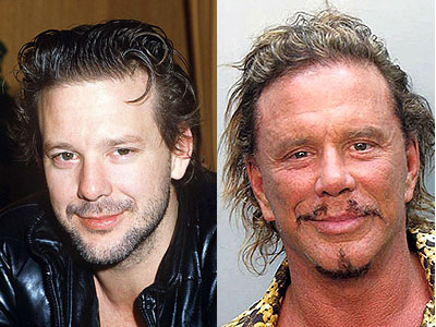 Mickey Rourke Plastic Surgery