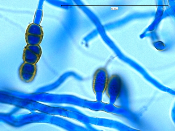 Fun With Microbiology (What's Buggin' You?): Pithomyces species