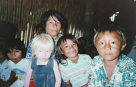 Deformutilation: Albinism Among The Kuna Indians
