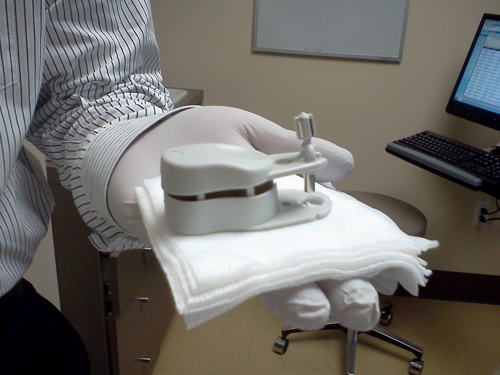 Diary of a Breast Cancer Patient: Day 166 - Tissue Expanders (and pictures)