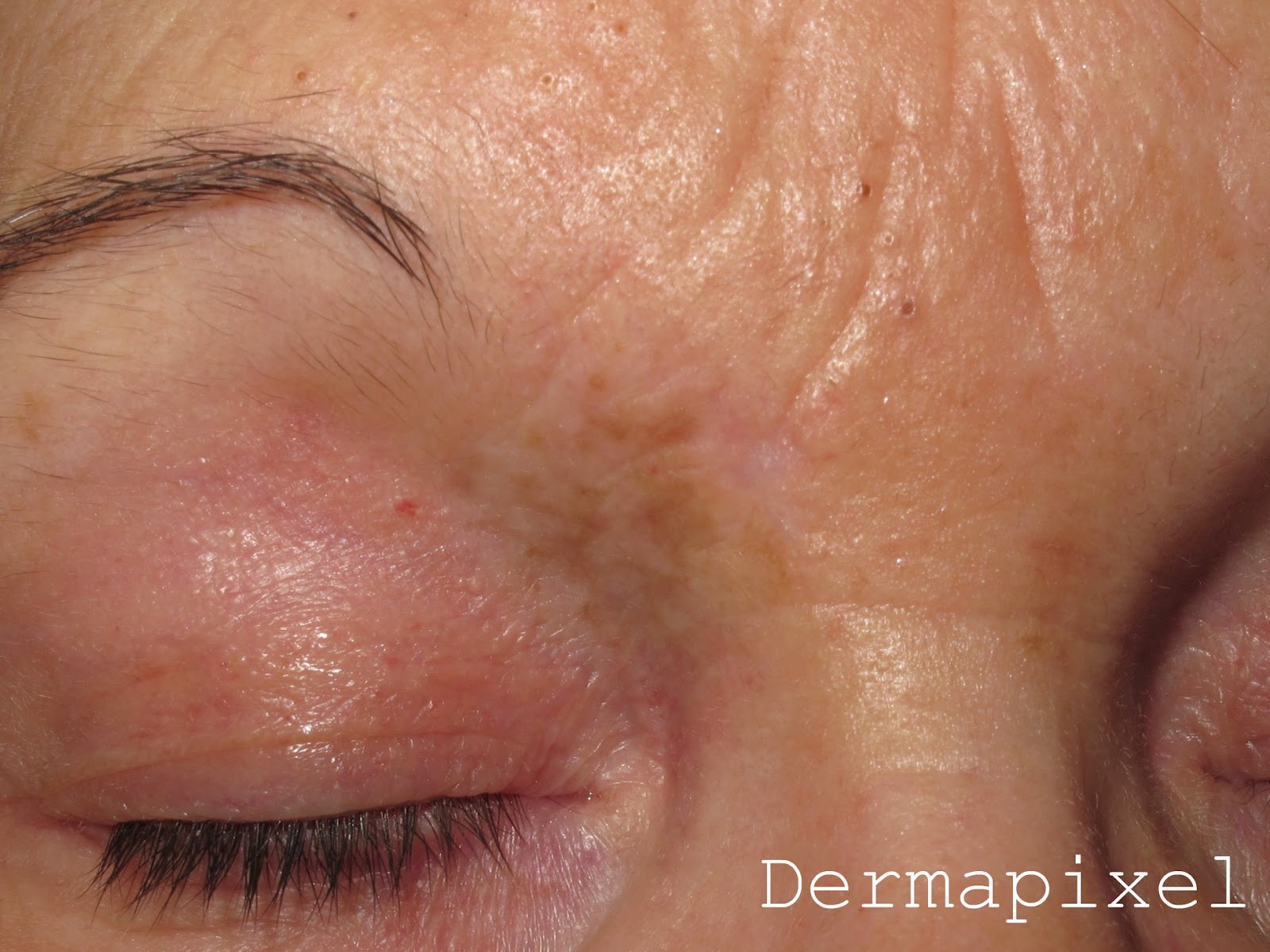 Dermapixel: agosto 2012