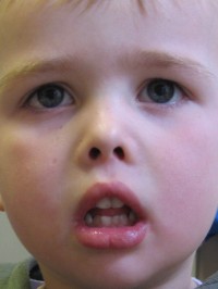 The Tooth Booth: What affects facial development in kids?
