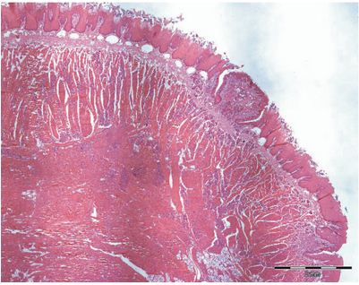 Struktur Anatomi Lidah dan Fungsi Bagian Lidah Manusia | Floem