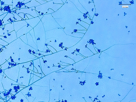 Trichothecium roseum - Alchetron, The Free Social Encyclopedia