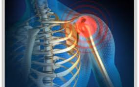 Rupa-rupa Paltot Gambar: Dislokasi pada Sendi Bahu