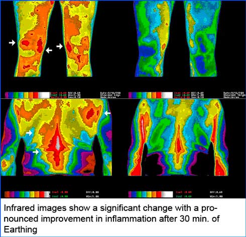 Understanding Brings Peace: Grounding/Earthing