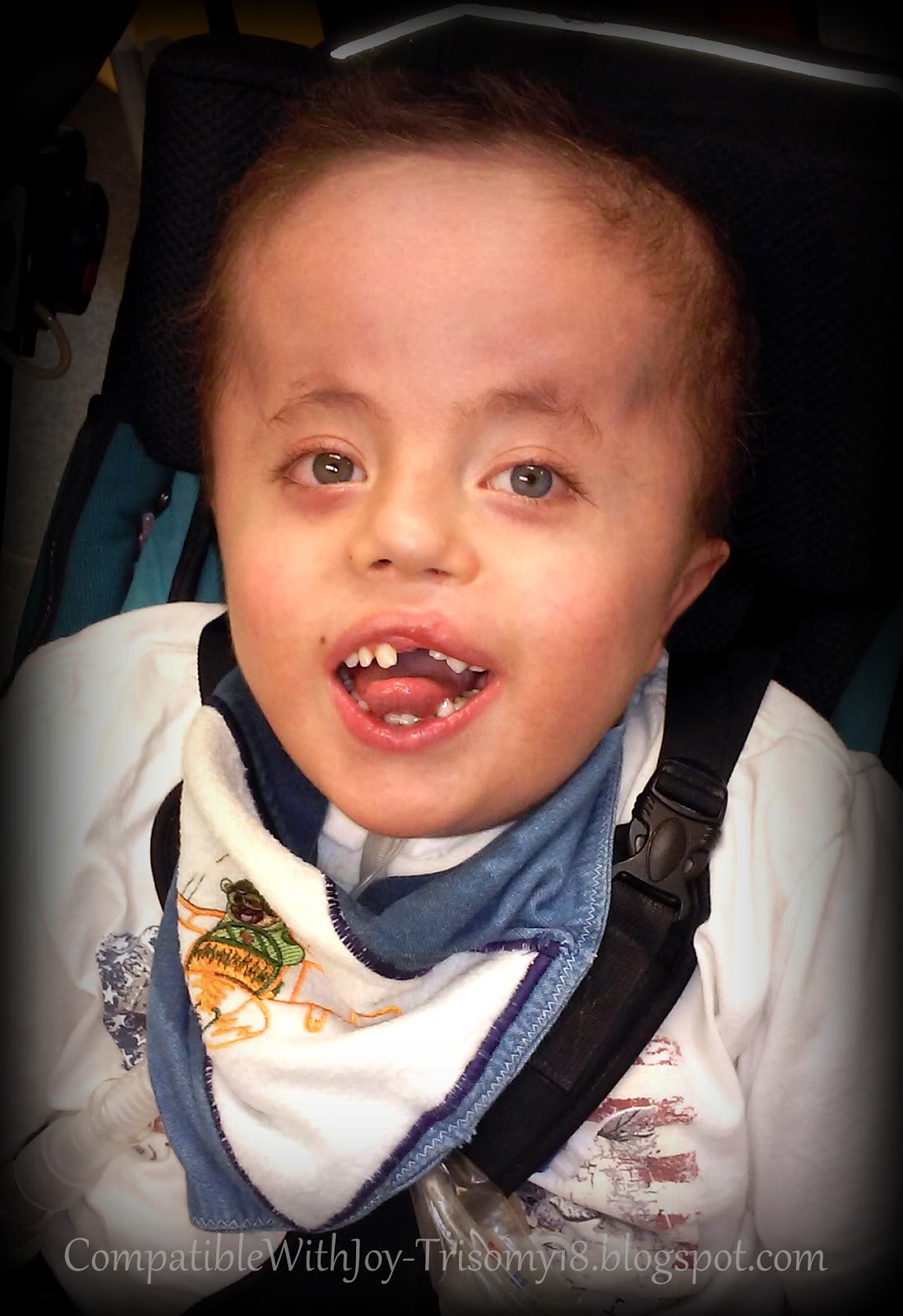 Compatible With Joy-Trisomy18: 09/01/2015 - 10/01/2015