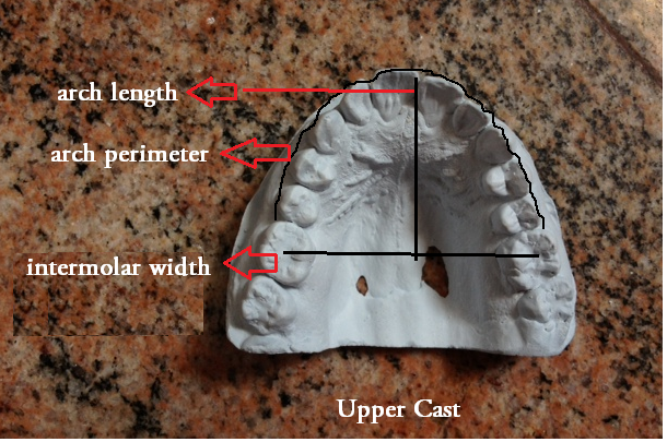 My Journey to LIFE. (previously My Invisalign Diaries): Let's get into ...