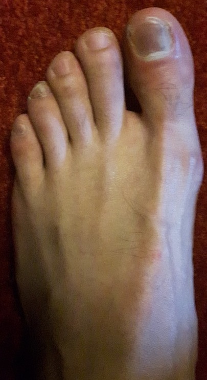 Ultrabikedad - Pushing the Limits: The Damage