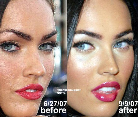 Megan Fox Before And After Plastic Surgery Photos