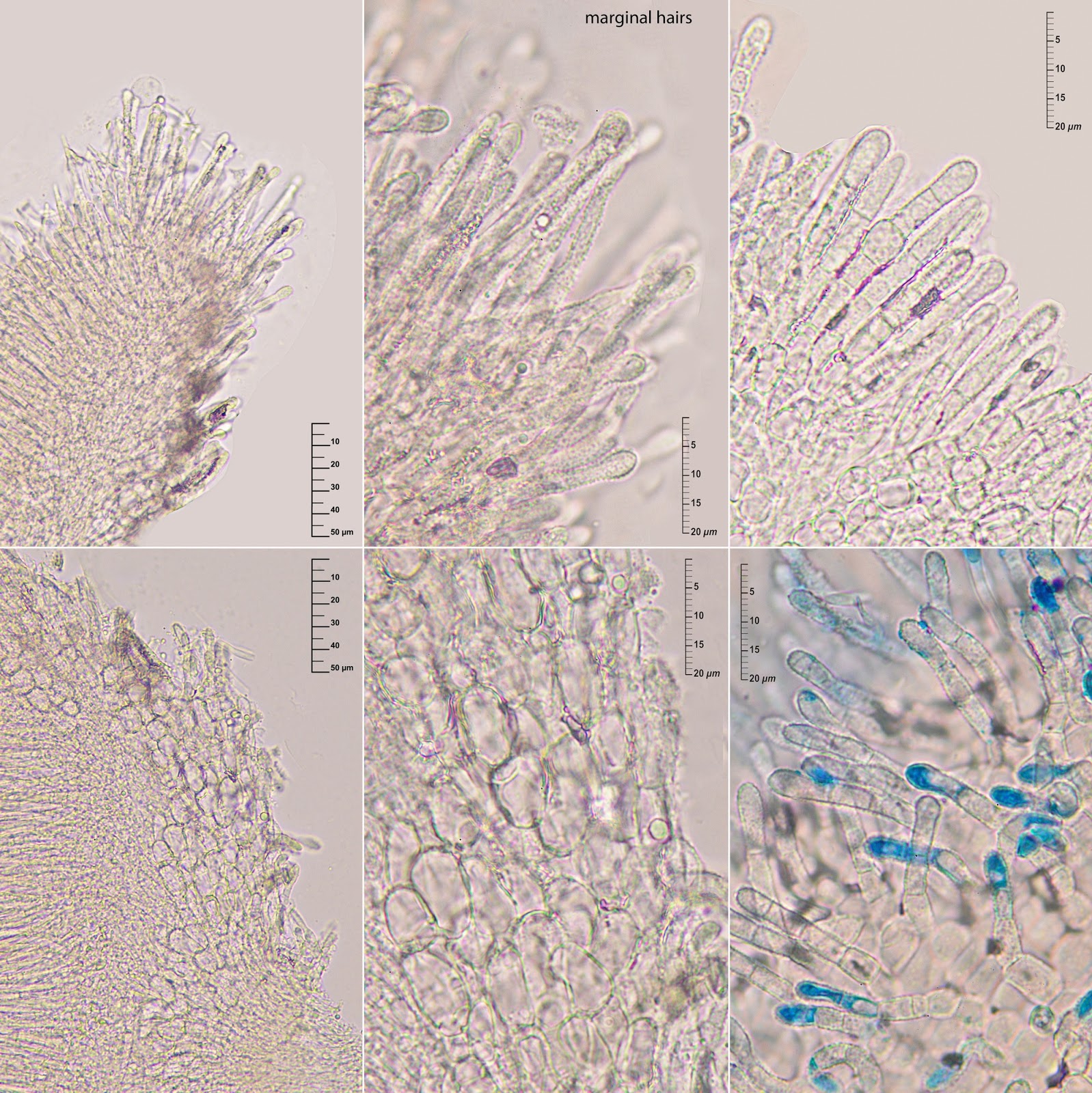 Lachnum longipilosum Svrček • CEMAS • Orden Helotiales