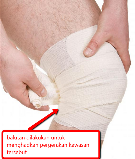 NewBie: RAWATAN KECEMASAN ( R.I.C.E )