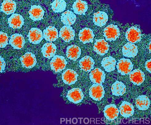 Enterovirus Type 71 (EV-71)