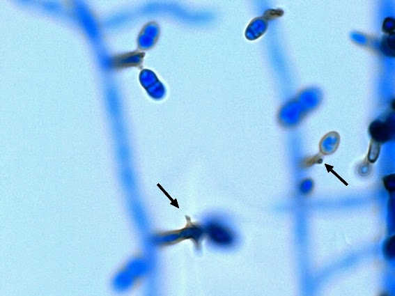 Fun With Microbiology (What's Buggin' You?): Ochroconis species