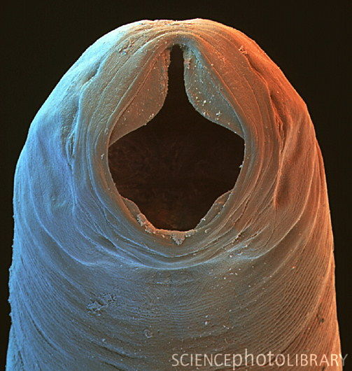 Infection Landscapes: Hookworm