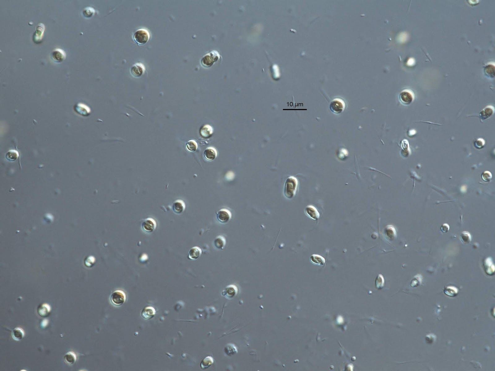 Laboratorio de Plancton: El plancton