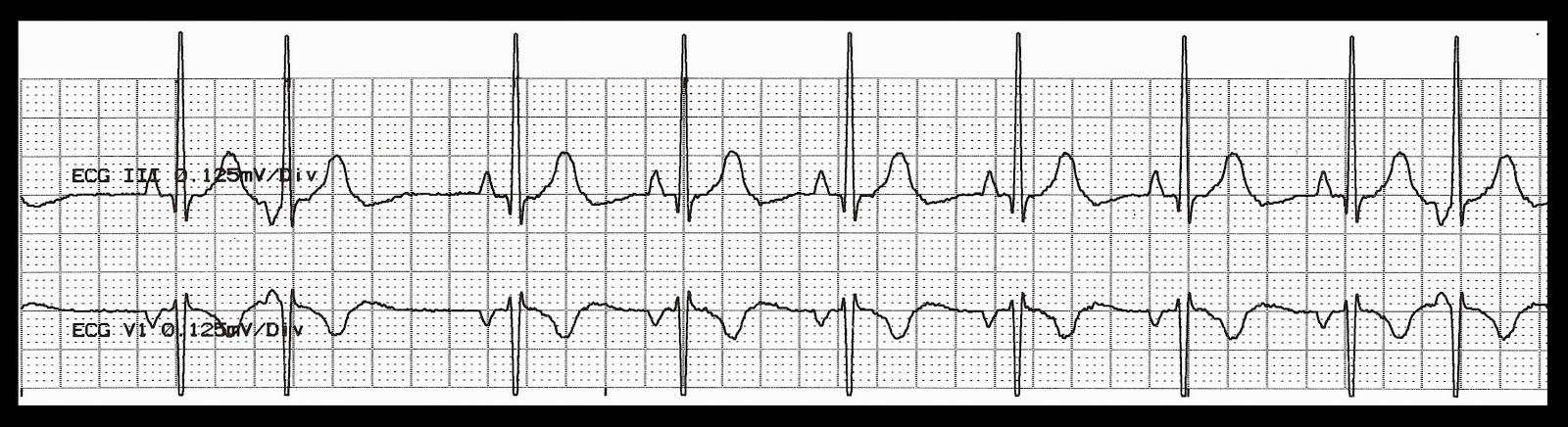 Float Nurse: EKG Rhythm Quiz 266
