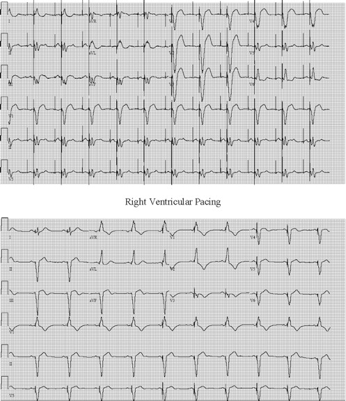 Dr Han Naung @ Henry Han : Electrophysiology and Heart Rhythm ...