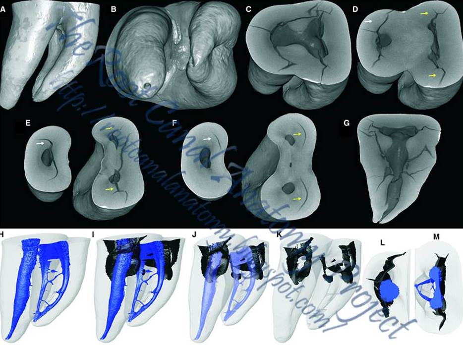 The Root Canal Anatomy Project: Publication: Review on Dentinal ...