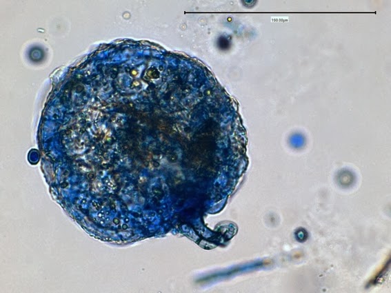 Fun With Microbiology (What's Buggin' You?): Eurotium herbariorum ...