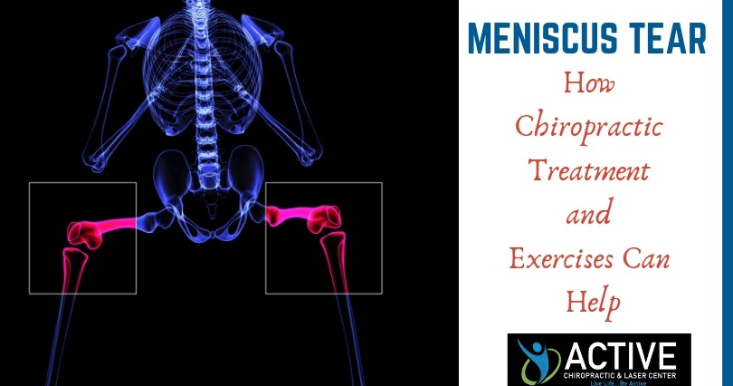 Chiropractic & Laser Therapy: Meniscus Tear: How Chiropractic Treatment ...