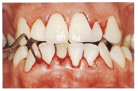 dental zone: periodontics