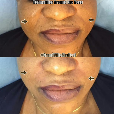 Battling with stretch marks, Wrinkled face, uneven skin, excess fat and ...