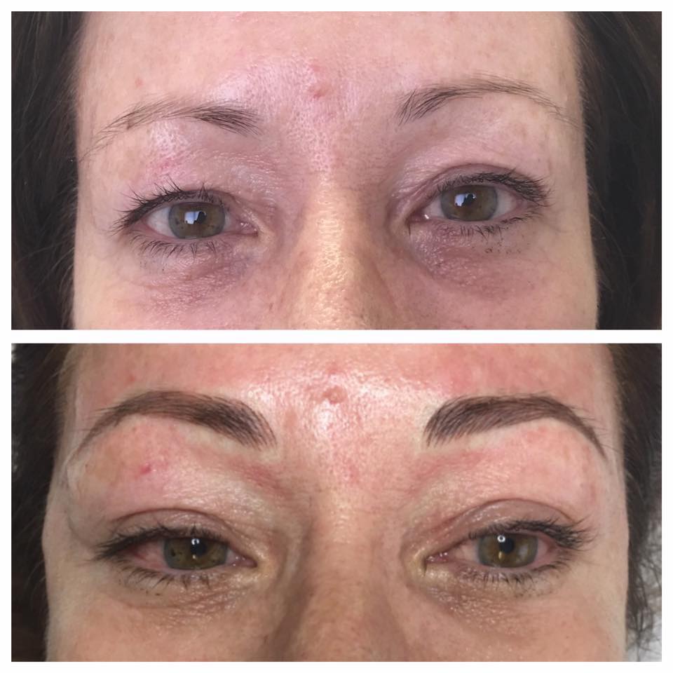 Selston Cosmetic Clinic: Micro Blading Eyebrows With Semi-Pemanent Make ...