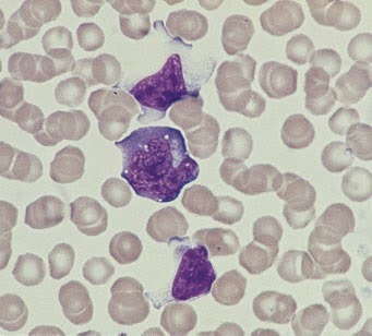 Assessing White Cells and Platelets | Tuyenlab