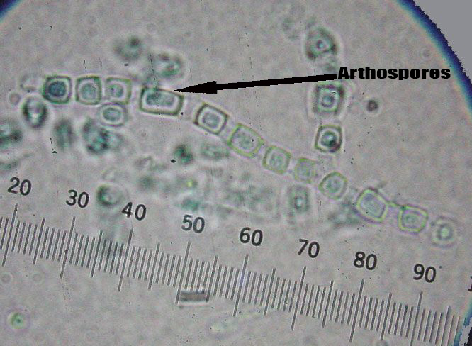 Fungal Structures and Mycology Terminologies Essential for ...