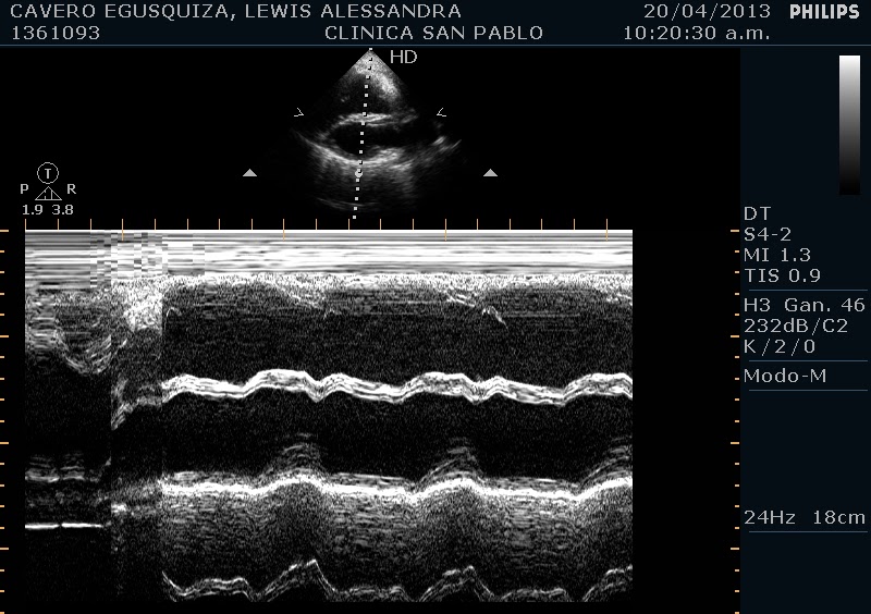 ECHOVAR: ECO DEL DIA: El maravilloso Modo M