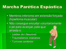 Tipos de Marchas Patológicas - Enfermagem em Ortopedia