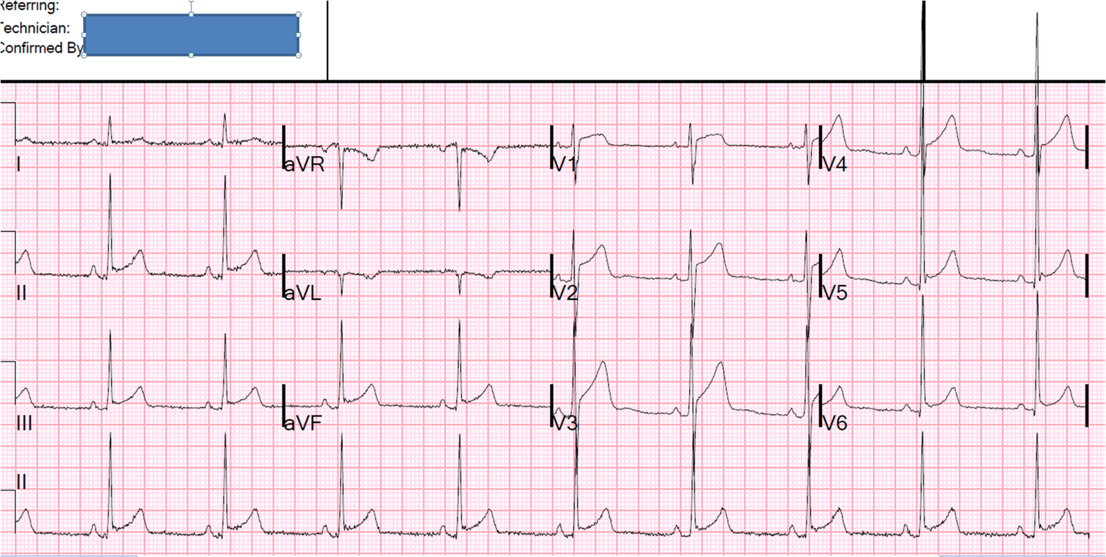 Dr. Smith's ECG Blog: September 2012