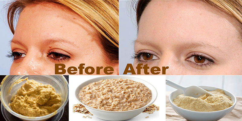 Magical Skin Whitening Home Remedies Miracle Formula Whitening Skin ...