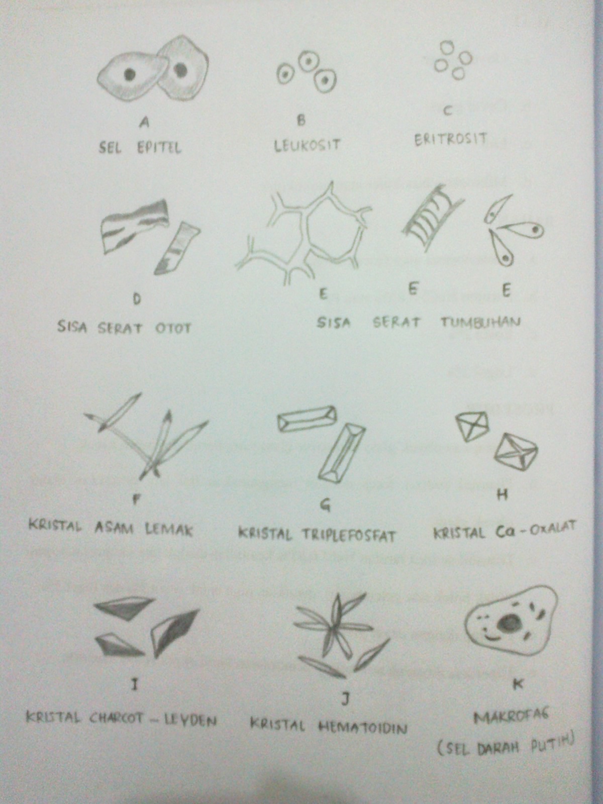 Rizqi Murtafi'ah: Pemeriksaan Feses Lengkap