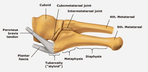 SportConsult MD: Fractura proximal del 5to metatarsiano. La lesión de ...