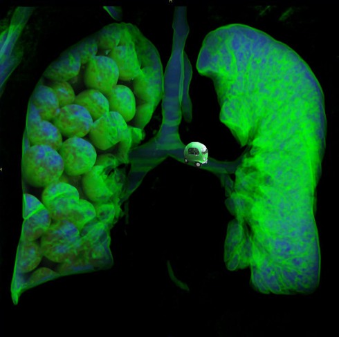 alamcyber 2020: Kacang pis tumbuh dalam paru-paru