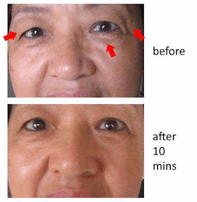 Elysyle Eternal Beauty (EB) Machine