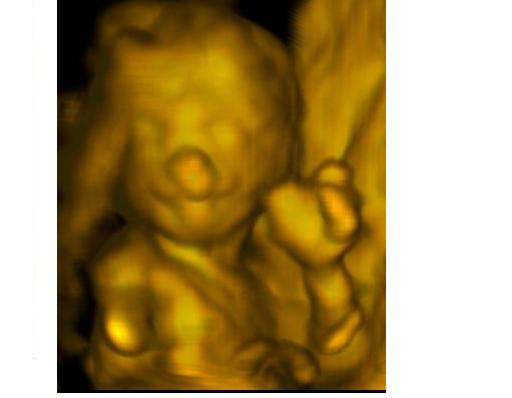 First Choice Baby Scan: 19 Weeks pregnant